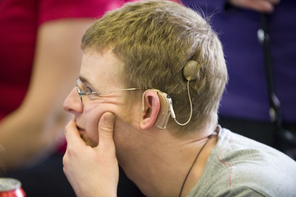 Benefits of a Cochlear Implant - Auditory Implant Service