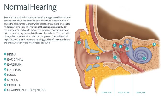 Cochlear Implants - Auditory Implant Service