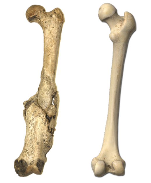 A skeleton from Anglo-Saxon times – Stories From Bones